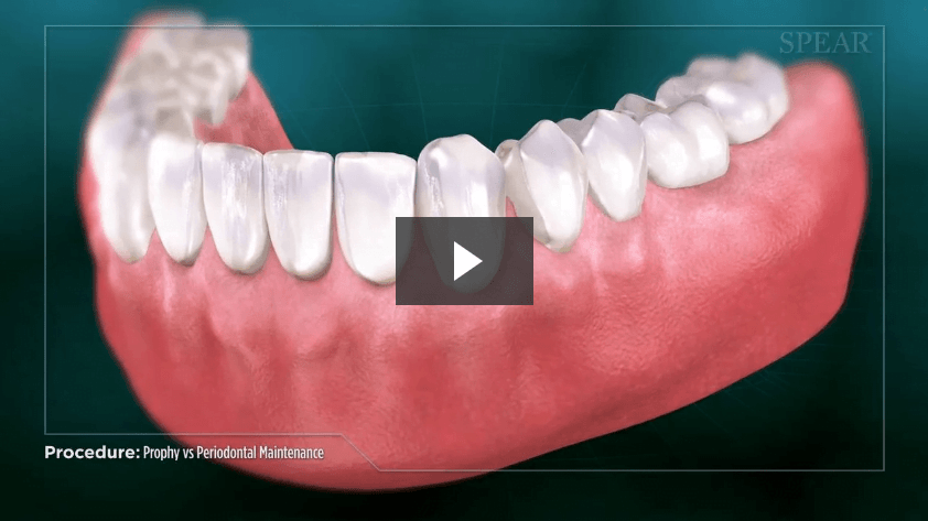 Prophy vs Periodontal Maintenance - Cosmetic Dentistry